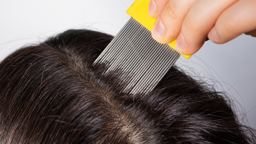 Lice Treatment at Home: How Our DIY Kit Helps Ventura County Families ...